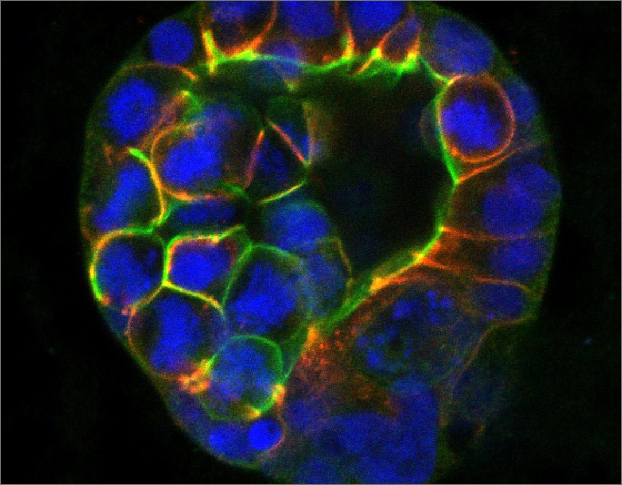Cancer Metabolism Goodman Cancer Institute